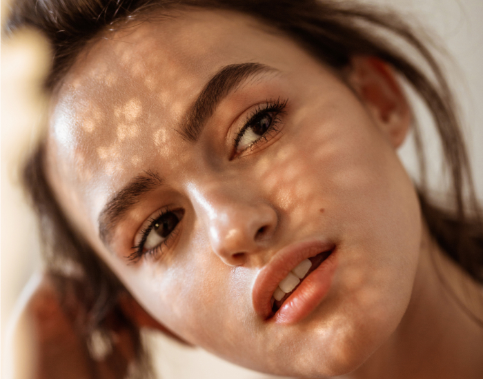 Dermal Fillers Lexington | Fillers Lexington | Lexington Med Spa